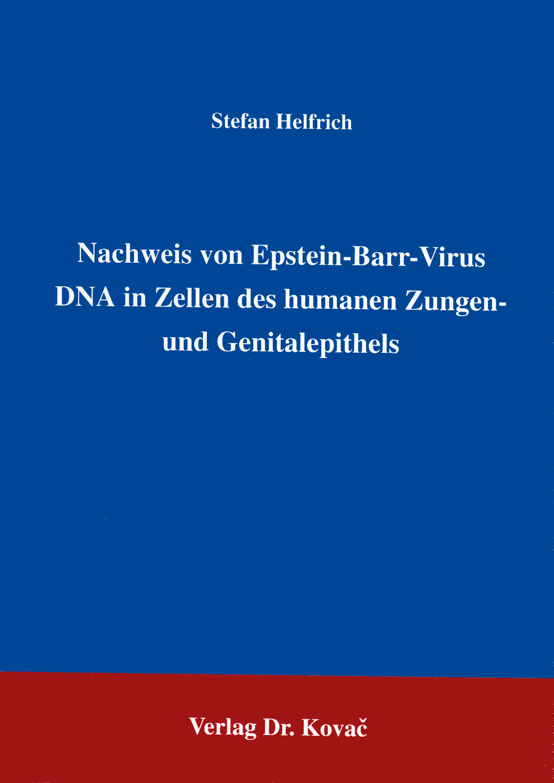 Nachweis von Epstein-Barr-Virus DNA in Zellen des humanen… (173)
